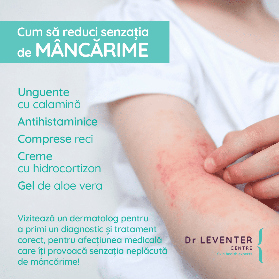 Boli de piele care provoaca mancarimi. Cum le recunosti si cand ...